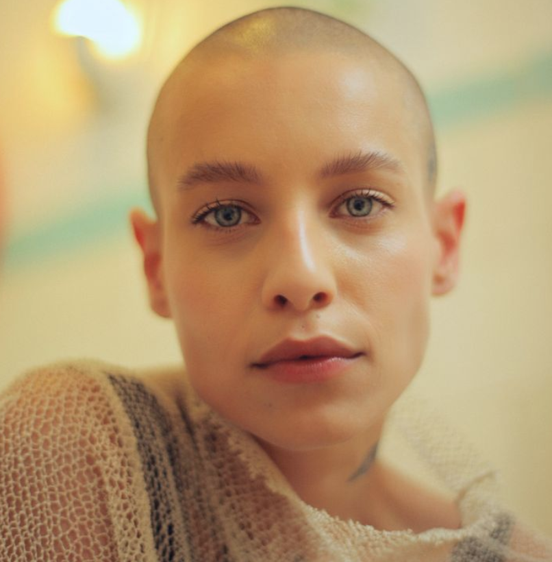 New SMP After 5 Years | The Best Solution For Hair Loss 2025